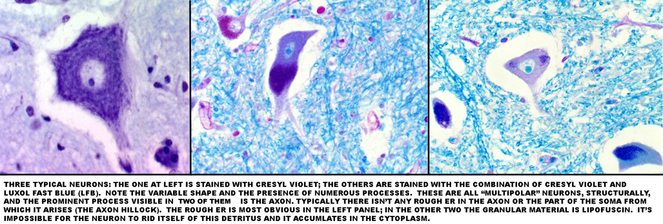 Bipolar Neuron Microscope